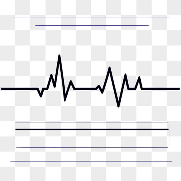 Download Medical Illustration of Electrocardiogram (ECG) PNGs Online ...